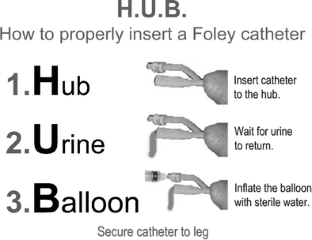 Urinary Catheterization: a Paradigm Shift in Difficult Urinary ...