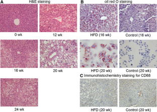 Adipogenic changes of hepatocytes in a high-fat diet-induced fatty ...