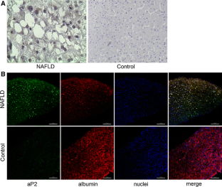 Adipogenic changes of hepatocytes in a high-fat diet-induced fatty ...