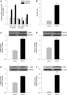 Adipogenic changes of hepatocytes in a high-fat diet-induced fatty ...