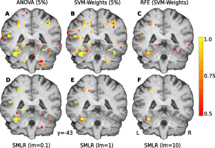 PyMVPA: a Python Toolbox for Multivariate Pattern Analysis of fMRI Data | SpringerLink