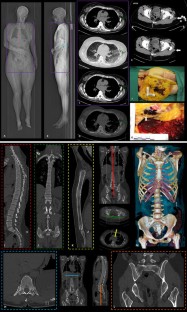 Imaging in forensic radiology: an illustrated guide for postmortem ...