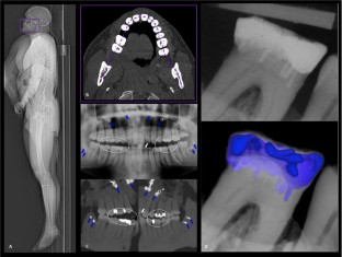 Imaging in forensic radiology: an illustrated guide for postmortem ...