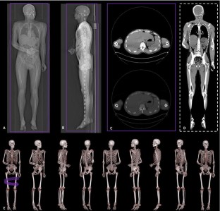 Imaging in forensic radiology: an illustrated guide for postmortem ...