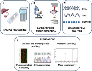 Laser capture microdissection: techniques and applications in liver ...