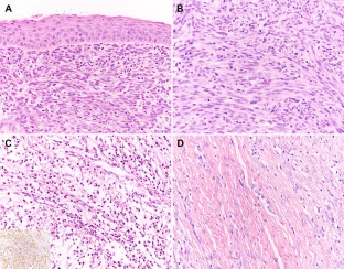 Soft Tissue Special Issue: Fibroblastic and Myofibroblastic Neoplasms ...