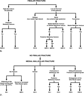 Ankle fracture: radiographic approach according to the Lauge-Hansen ...