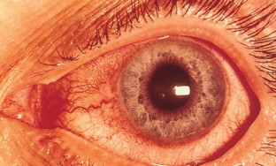 Het OOG ANATOMIE / FYSIOLOGIE | SpringerLink