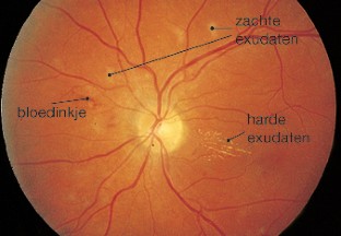 Het OOG ANATOMIE / FYSIOLOGIE | SpringerLink
