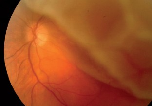 Het OOG ANATOMIE / FYSIOLOGIE | SpringerLink