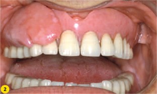 Fibromen en fibroomachtige zwellingen | SpringerLink