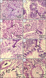 Structure of the intratesticular duct system for sperm emission in the ...
