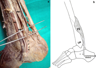 The peroneus quartus muscle: clinical correlation with evolutionary ...