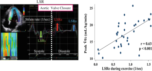 Exercise stress echocardiography in hypertrophic cardiomyopathy ...
