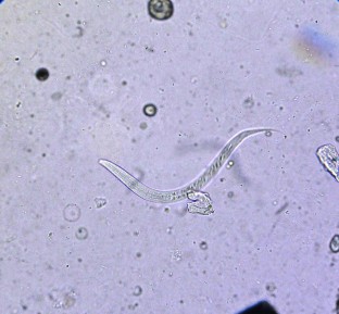 Spectrum of parasitic infections in centrifuged urine sediments from a ...