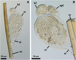 Transcriptome profiling of Symbion pandora (phylum Cycliophora ...