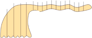 Evaluation of SEE-FIM (Sectioning and Extensively Examining the ...