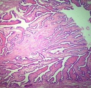 Evaluation of SEE-FIM (Sectioning and Extensively Examining the ...