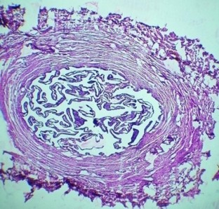 Evaluation of SEE-FIM (Sectioning and Extensively Examining the ...