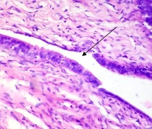 Evaluation of SEE-FIM (Sectioning and Extensively Examining the ...