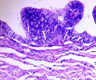Evaluation of SEE-FIM (Sectioning and Extensively Examining the ...