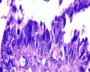 Evaluation of SEE-FIM (Sectioning and Extensively Examining the ...