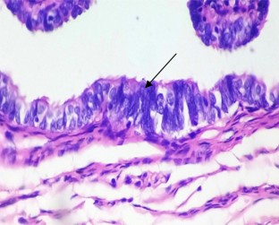 Evaluation of SEE-FIM (Sectioning and Extensively Examining the ...