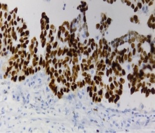 Evaluation of SEE-FIM (Sectioning and Extensively Examining the ...
