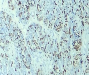 Evaluation of SEE-FIM (Sectioning and Extensively Examining the ...