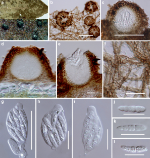 Capnodiaceae | SpringerLink