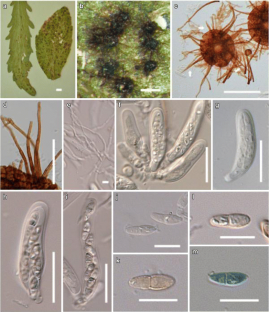Families of Dothideomycetes | SpringerLink