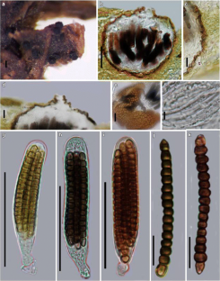 Families of Dothideomycetes | SpringerLink