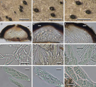 Families of Dothideomycetes | SpringerLink