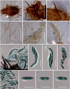 Families of Dothideomycetes | SpringerLink