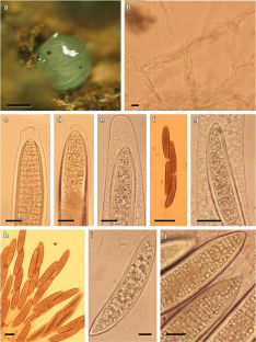 Families of Dothideomycetes | SpringerLink