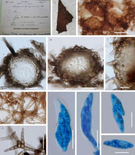 Families of Dothideomycetes | SpringerLink