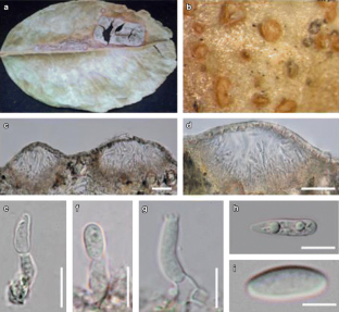 Families of Dothideomycetes | SpringerLink