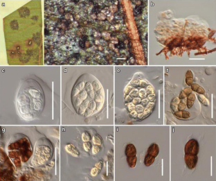 Families of Dothideomycetes | SpringerLink
