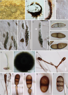 Families of Dothideomycetes | SpringerLink