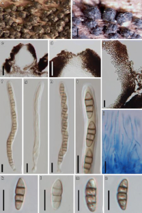 Families of Dothideomycetes | SpringerLink