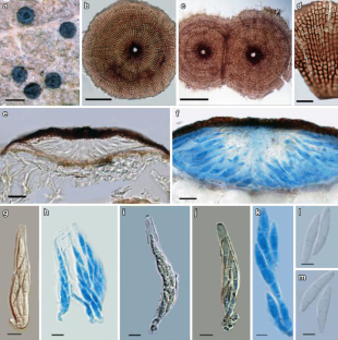 Families of Dothideomycetes | SpringerLink