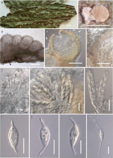 Families of Dothideomycetes | SpringerLink