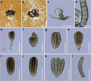 Dictyosporiaceae fam. nov. | SpringerLink