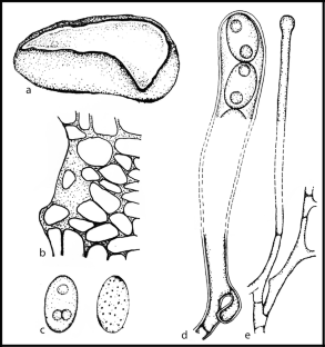 Taxonomy and phylogeny of operculate discomycetes: Pezizomycetes ...