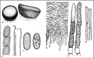 Taxonomy and phylogeny of operculate discomycetes: Pezizomycetes ...