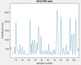 Detection and analysis: driver state with electrocardiogram (ECG ...