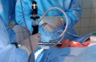 Transoral thyroidectomy: limitations, patients’ safety, and own ...