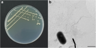 Burkholderia gladioli causes bacterial internal browning in sweetpotato ...