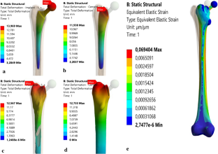 Optimal Material Selection for Total Hip Implant: A Finite Element Case ...