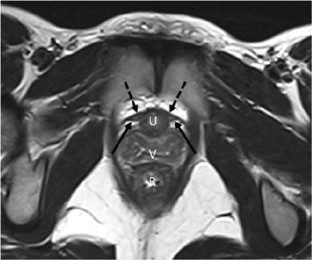Magnetic Resonance Imaging of Female Pelvic Floor Dysfunction: A Review ...